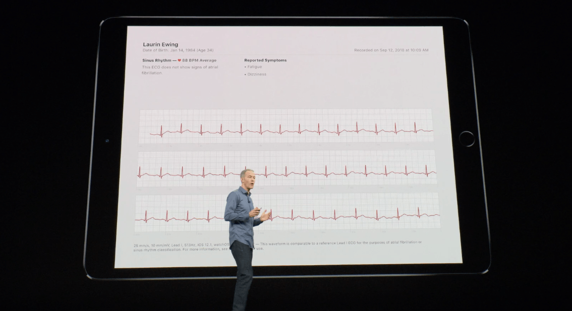 Nieuwe Apple Watch herkent atrium fibrilleren en maakt hartritme ...